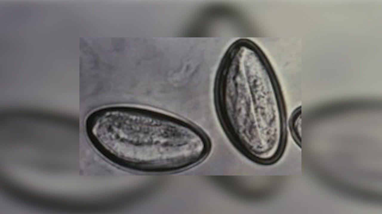 Pinworm parasite is infecting kids at a Warwick school