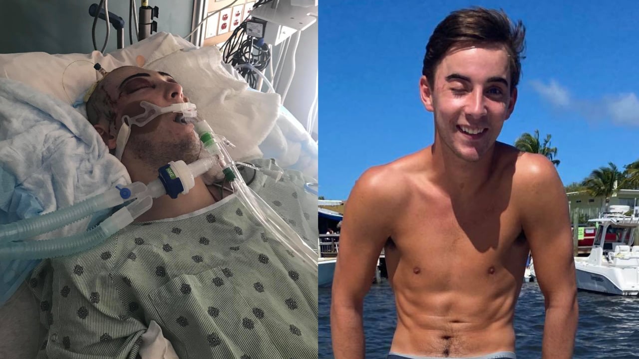 20-year-old making miraculous recovery after traumatic brain injury ...