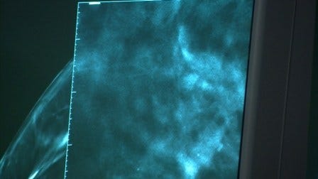 New mammogram technology improves early detection