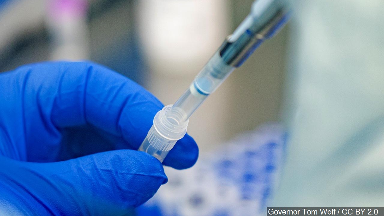 CHI Health to begin COVID-19 testing Friday