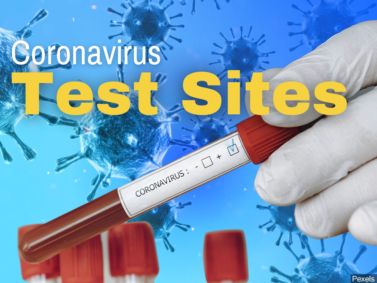 Local COVID-19 testing sites
