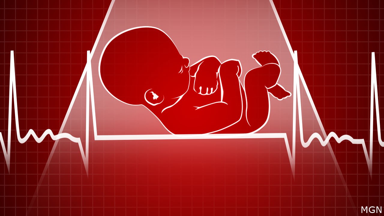 Report: higher maternal & infant death rates in abortion ban states