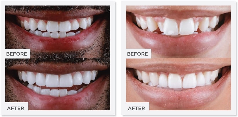 Orlando's Top Dentist Spotlight Series: Dynamic Smile Design - Orlando ...