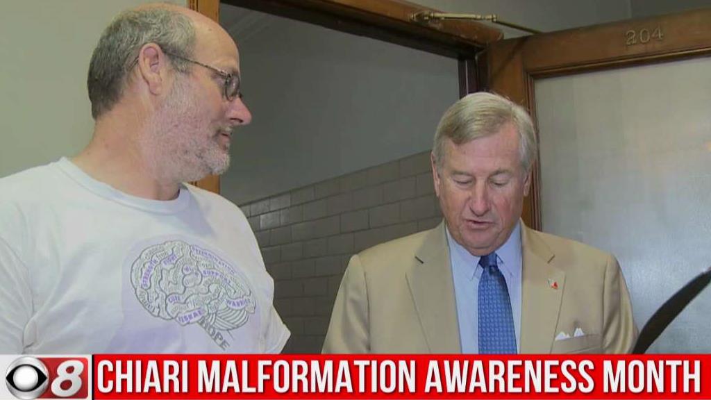 Montgomery Mayor Todd Strange Proclaims Chiari Malformation Awareness ...