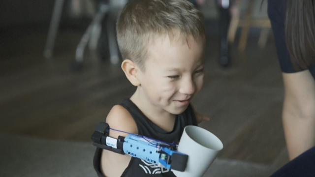 8-year-old gets prosthetic arm made of LEGOs - WBBJ TV