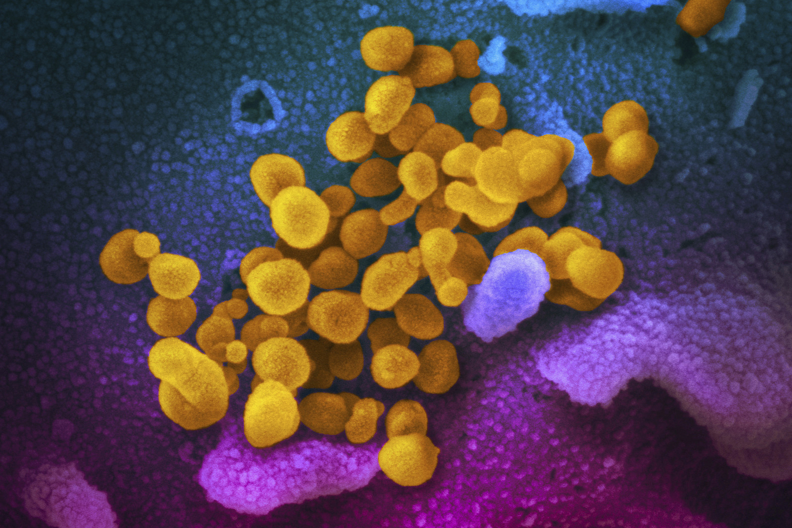 us-study-finds-1-in-10-get-long-covid-after-omicron-starts-identifying