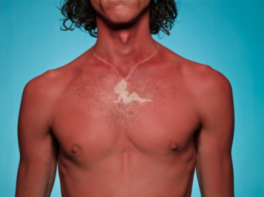 Sunburned guy with mud flap girl burnt on his chest - WCCB Charlotte