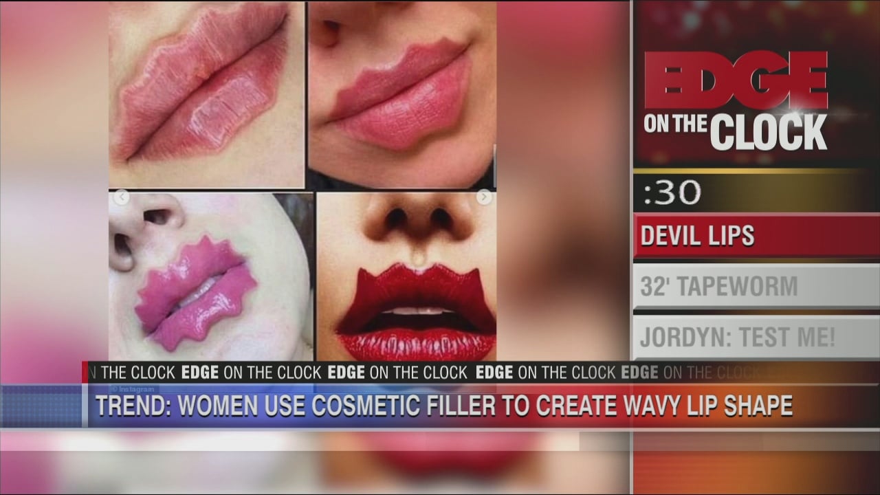 Edge On The Clock: "Devil" or "Octopus" Lips Latest Bizarre Beauty ...