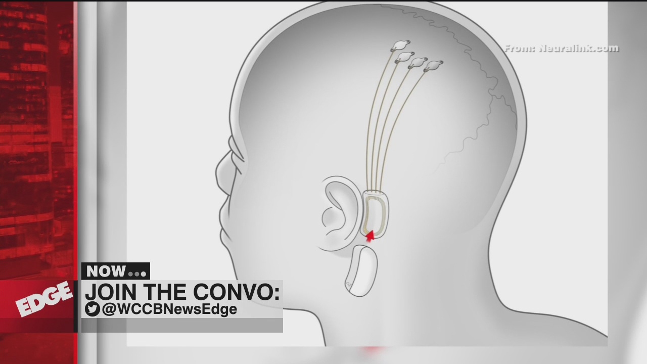 Control Your Devices From Your Brain? Elon Musk Says His New Brain Chip ...