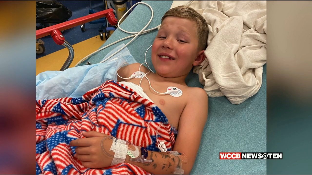 7-Year-Old Gaston Co. Boy Recovering From Second Degree Burns After ...