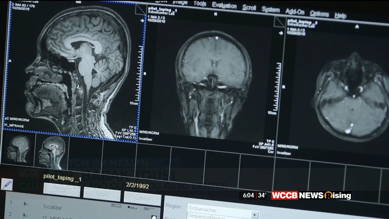 New Alzheimer's Drug Has Promise - WCCB Charlotte's CW