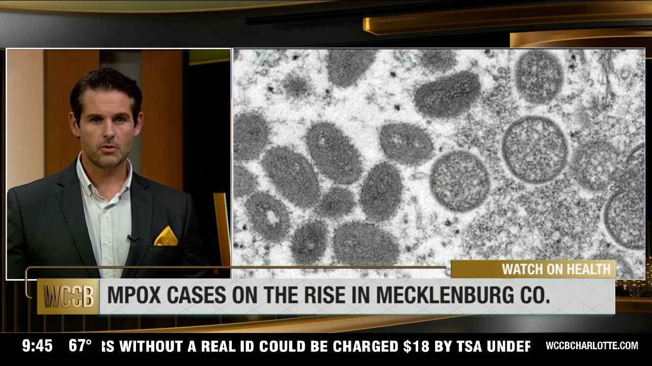 Mpox cases on the rise in Mecklenburg County - WCCB Charlotte