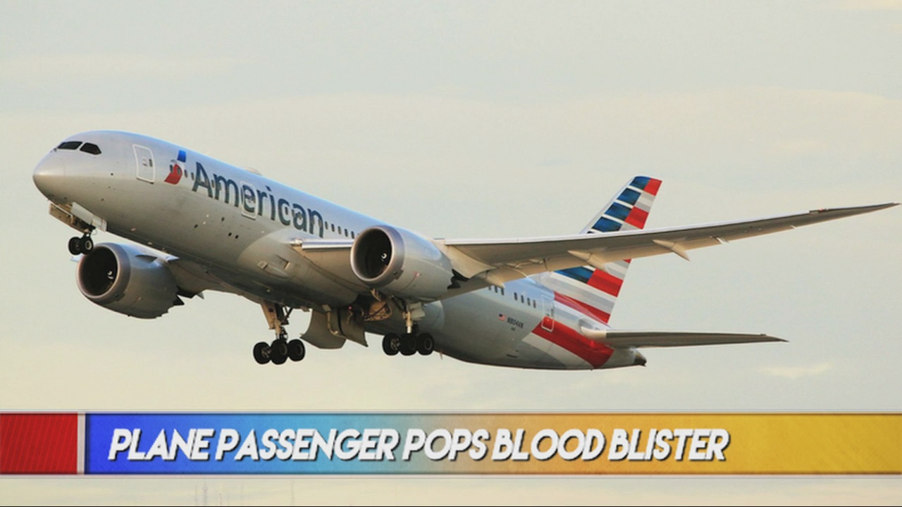 Plane Passenger Pops Blood Blister - WFXB