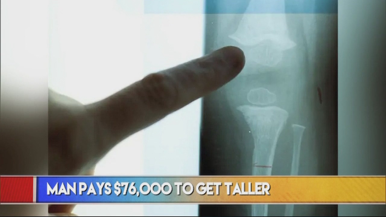 Growth Surgery - WFXB