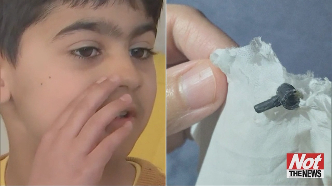 Lego Falls Out Of Boys Nose After Being Stuck For 2 Years - WFXB