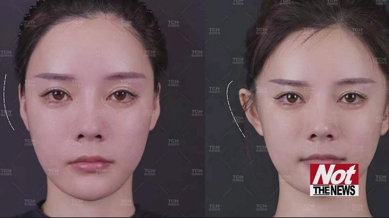 Elf Ear Surgery Has Become a Trend - WFXB