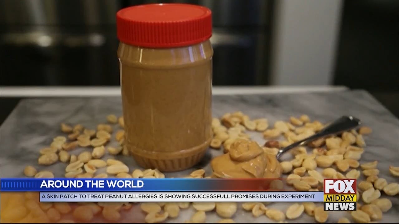 New Peanut Allergy Patch Shows Promises During Testing - WFXB