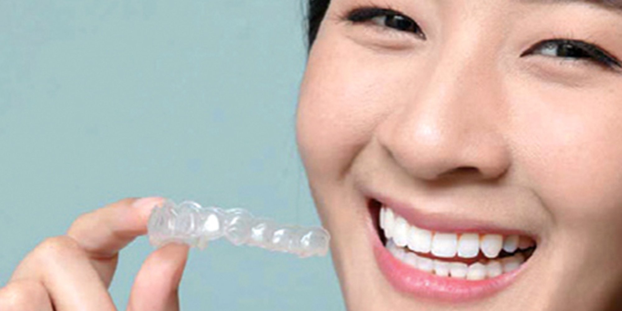 At-Home Aligners: Something To Smile About - WILMA magazine
