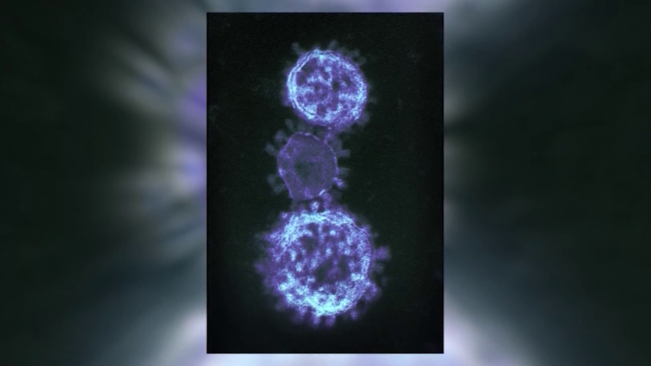 CDC adds six more possible symptoms of Coronavirus, includes headaches ... CDC adds six more possible symptoms of Coronavirus, includes headaches ...