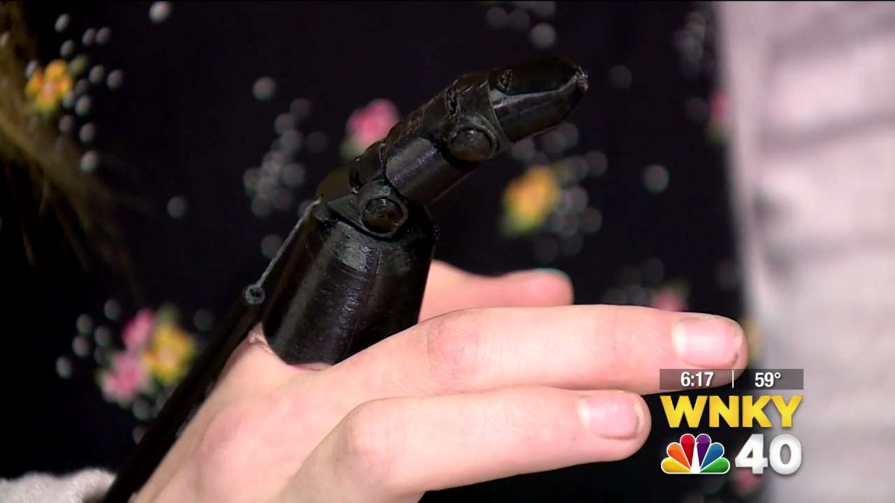 Living Well - 3D finger - WNKY News 40 Television