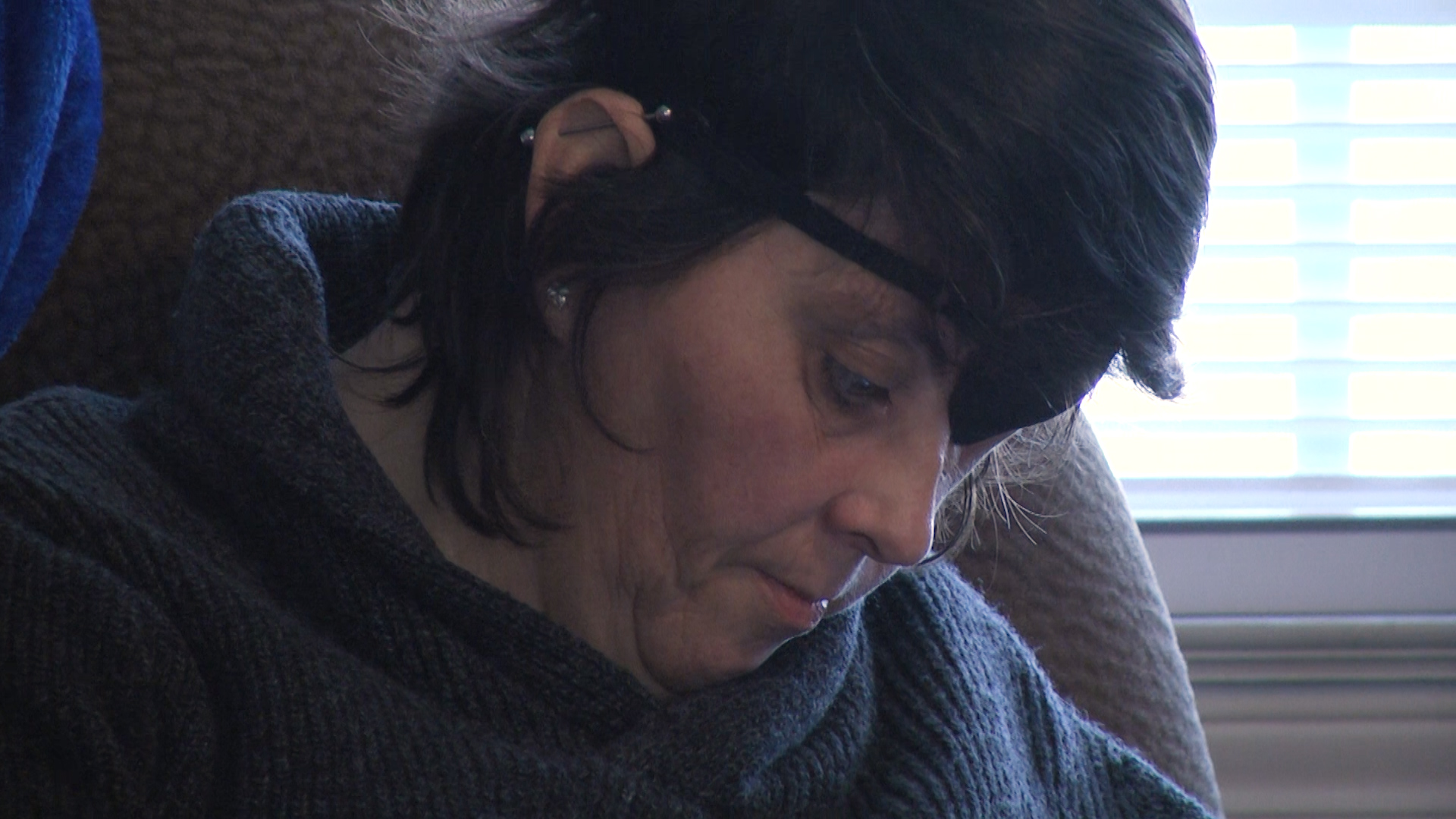 Firework accident survivor uses story to encourage safety and faith ...