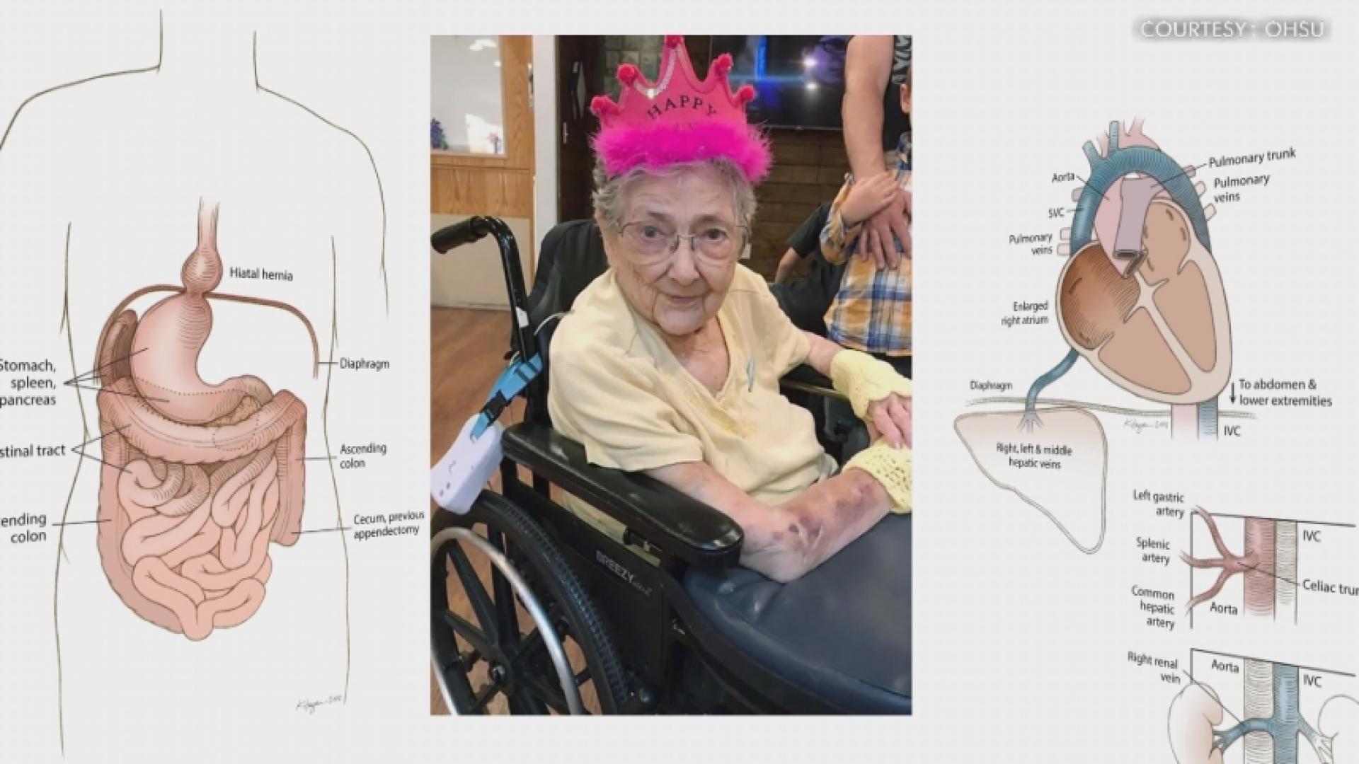 Medical miracle: "backwards" organs - WNKY News 40 Television