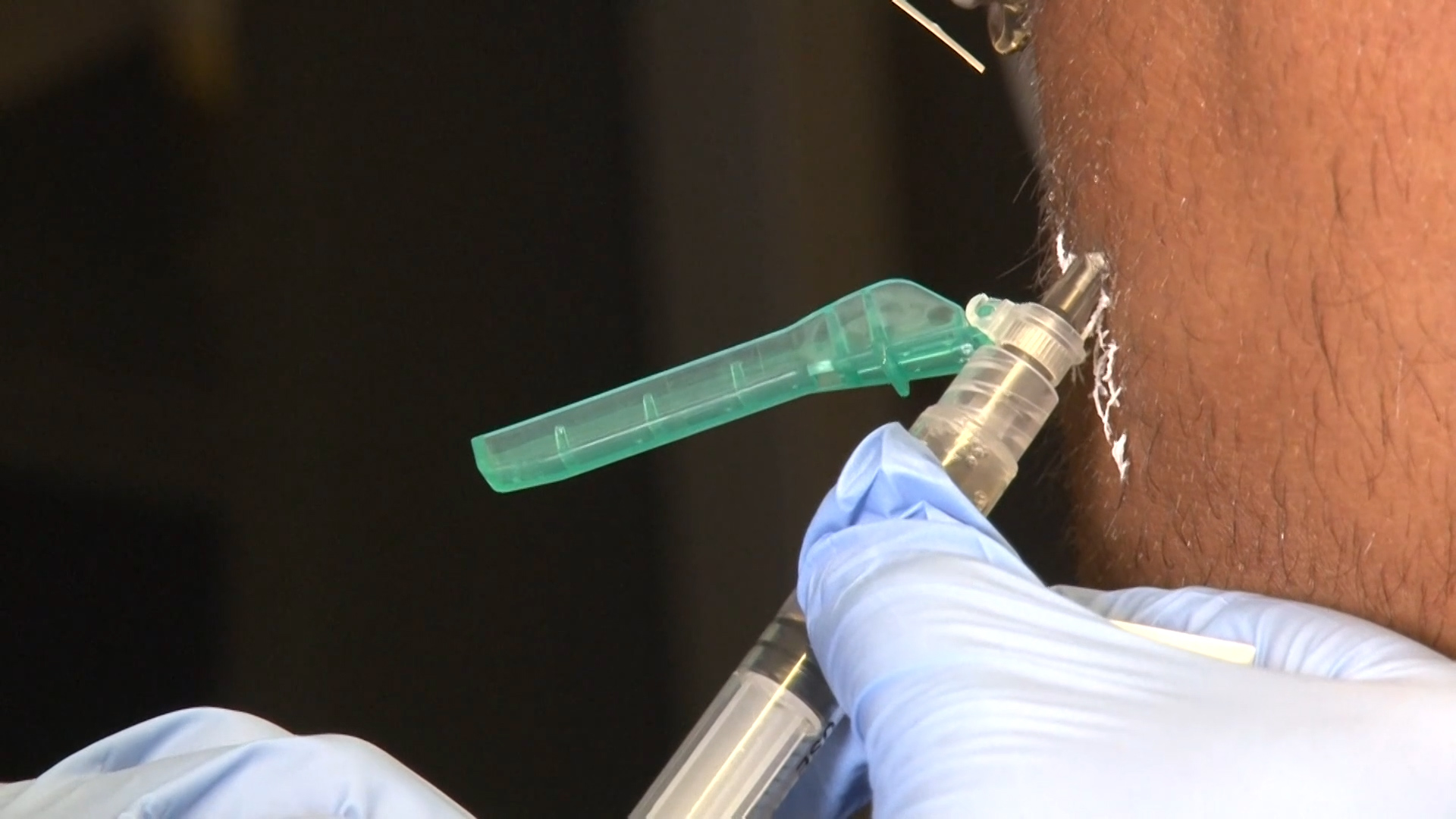 Living Well - Stem cell surgery - WNKY News 40 Television