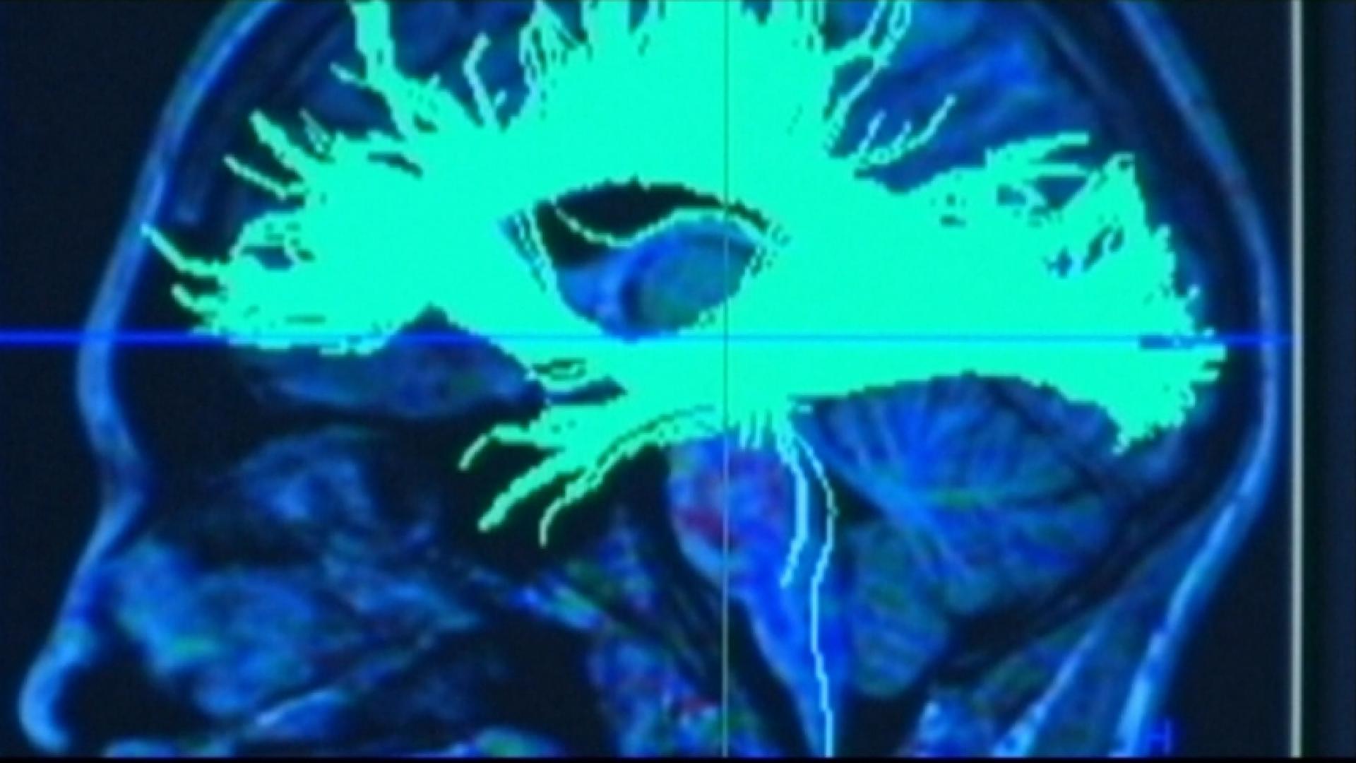 Coronavirus & The Brain - WNKY News 40 Television