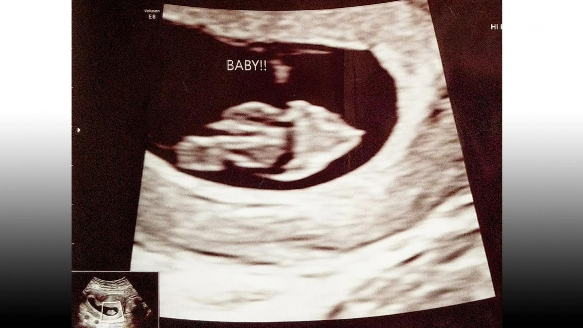 Quarantine Babies - WNKY News 40 Television