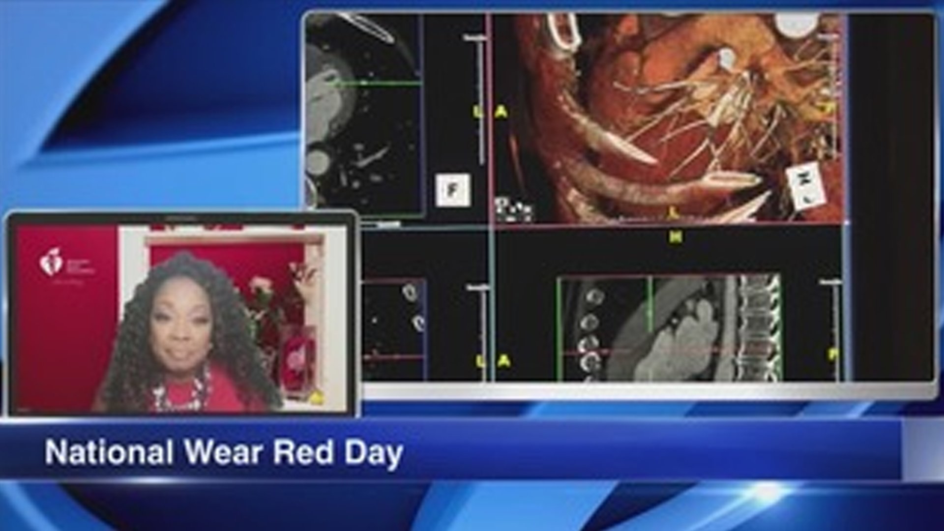 Wear Red Day 2021 raises awareness about heart disease in women - WNKY ...