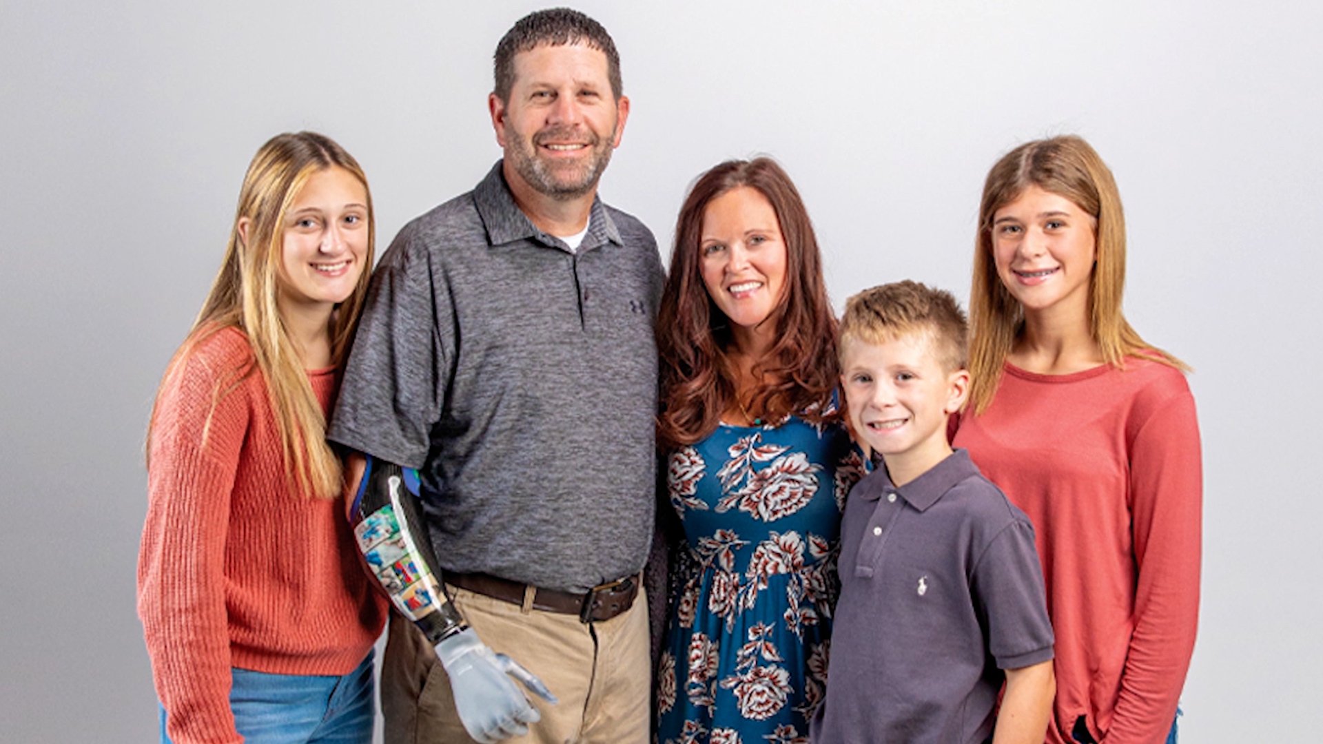 Monday Motivator - Jason Koger, the Bionic Man - WNKY News 40 Television