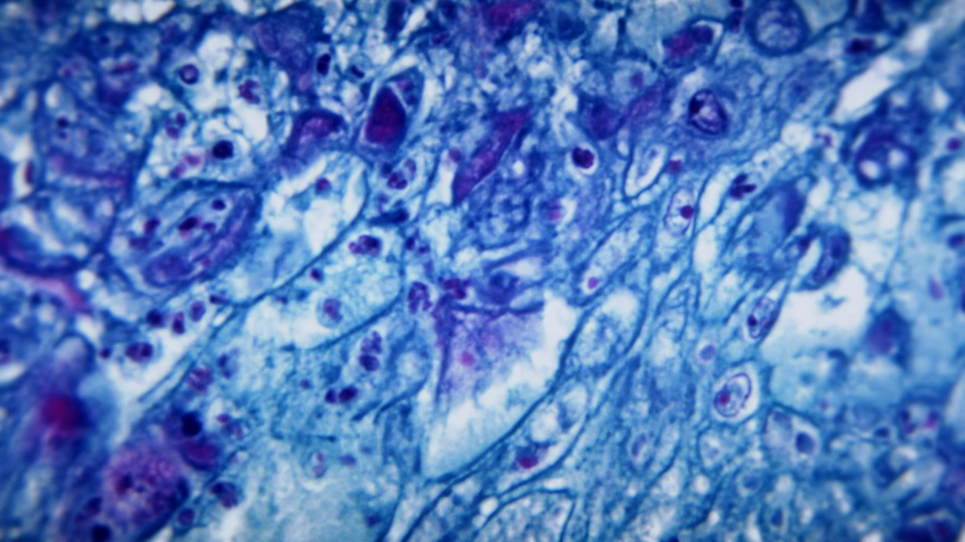 Monkeypox in kids: what you need to know - WNKY News 40 Television