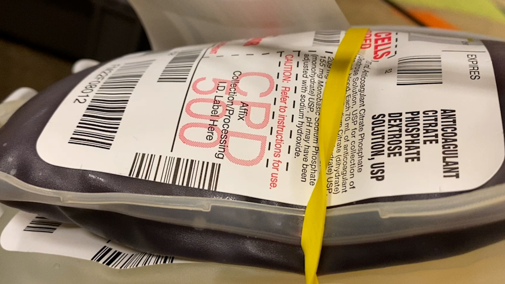 Flu season to impact blood supply- donate now! - WNKY News 40 Television