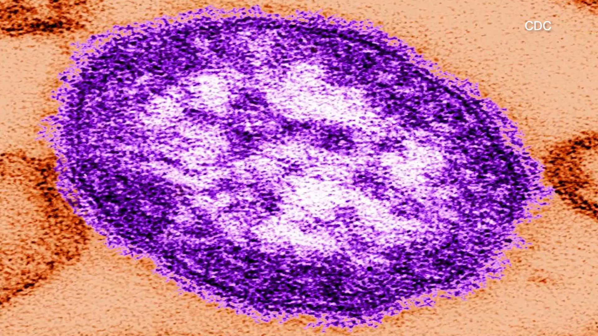 Are You Vaccinated Against Measles Check Immunizations After Outbreak are-you-vaccinated-against-measles-check-immunizations-after-outbreak