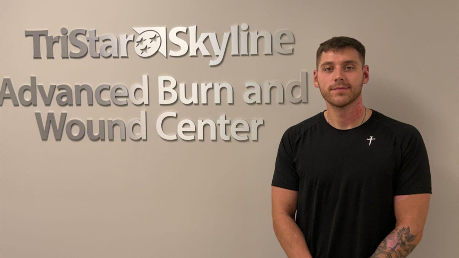Glasgow firefighter recovering from burn injuries, working to return to ...